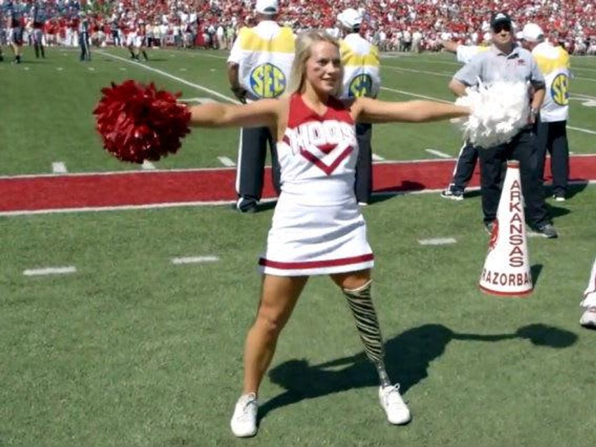 Patience Beard's prosthesis hasn't deterred her from becoming a ...